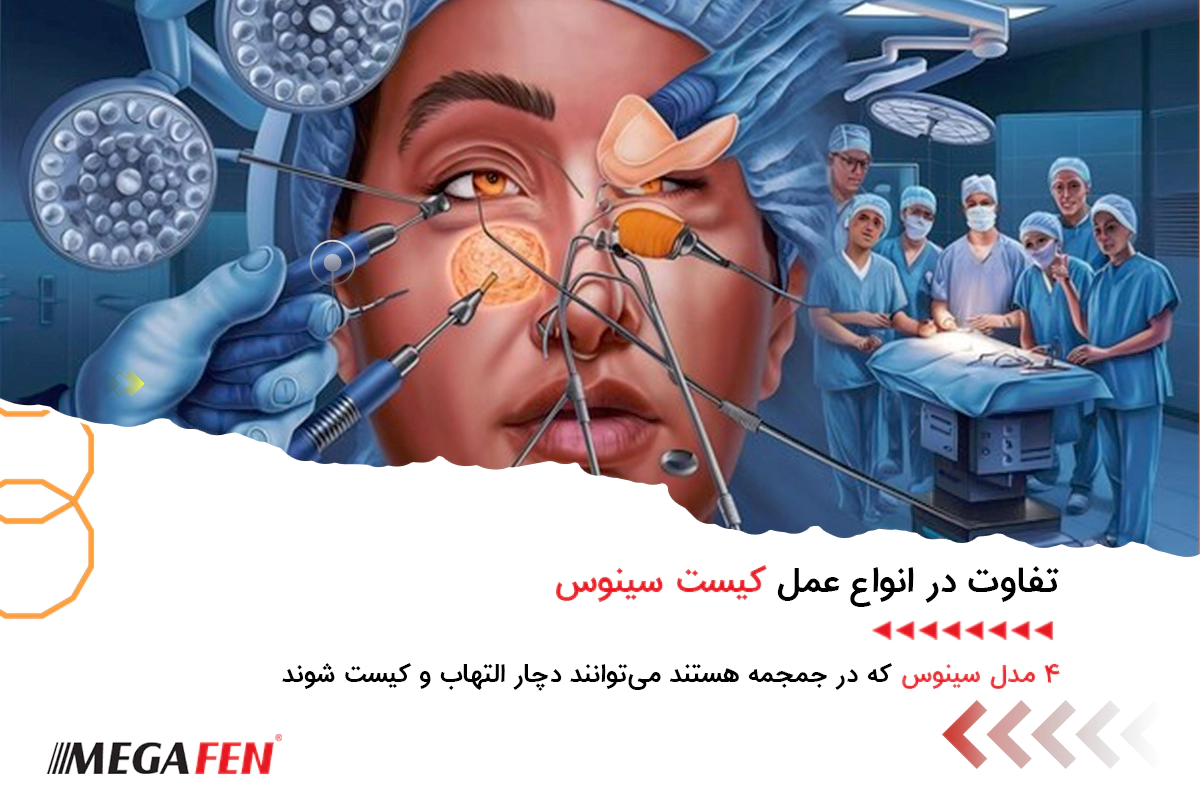 عمل کیست سینوس: راهنمایی جامع برای تشخیص و درمان - مگافن