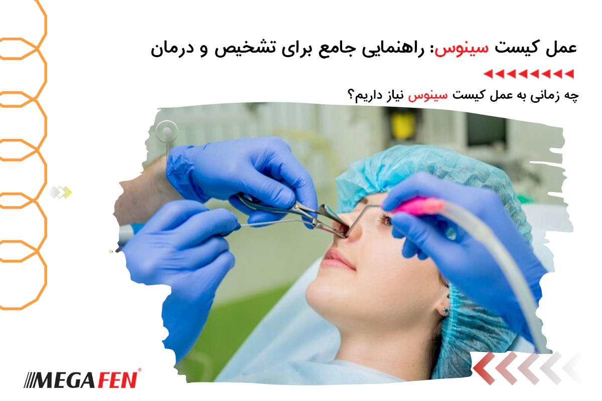عمل کیست سینوس: راهنمایی جامع برای تشخیص و درمان - مگافن