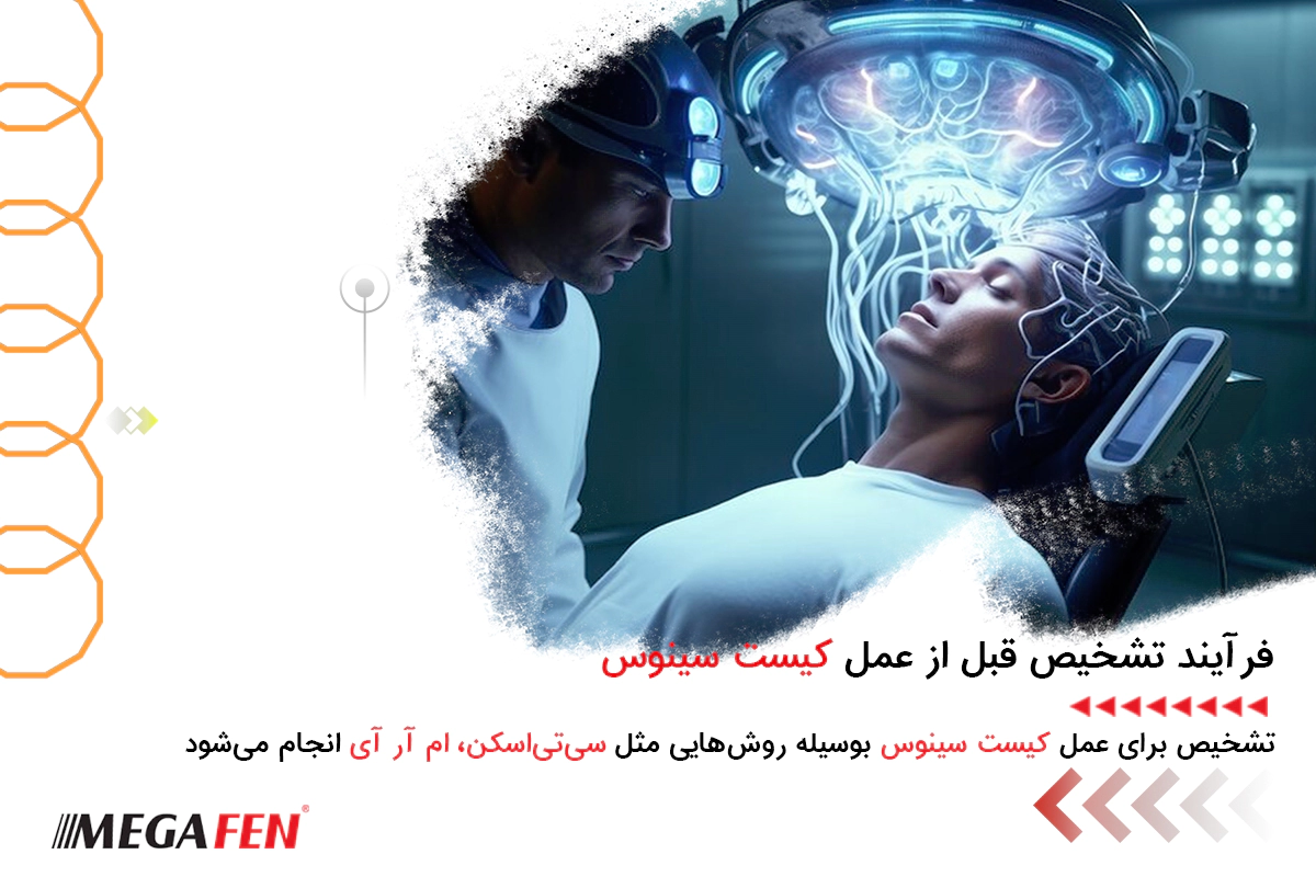 عمل کیست سینوس: راهنمایی جامع برای تشخیص و درمان - مگافن