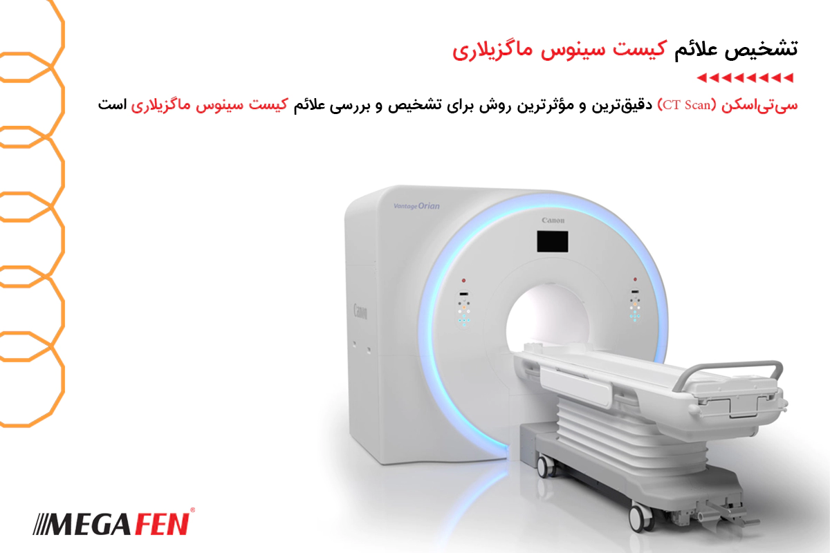 خطرات و علائم کیست سینوس ماگزیلاری - مگافن