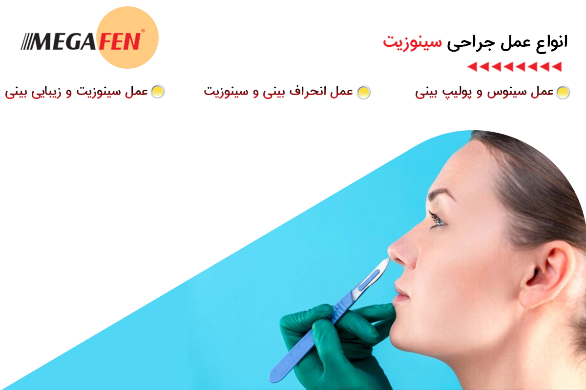 عمل سینوزیت چگونه است؟ تاثیر عمل سینوس بینی بر پولیپ و انحراف بینی - مگافن